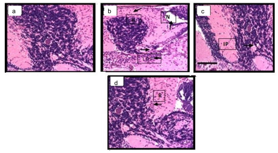 Facilitating the gut brain axis by probiotic bacteria to modulate ...