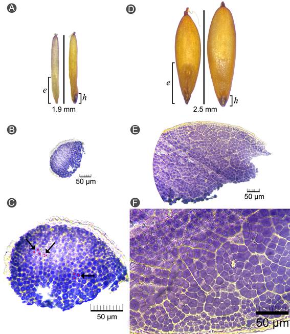 Endosperm starch grains of Andropogon, Arthraxon hispidus, and ...